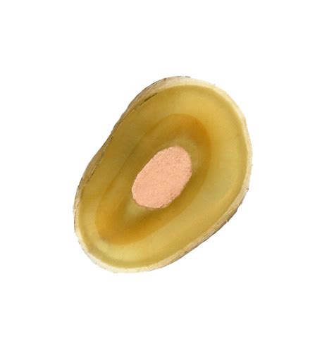 Effect Of Different Irrigation Protocols On The Radicular Dentin