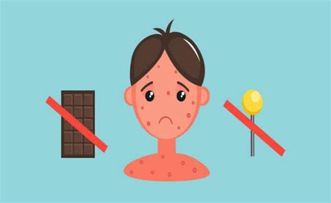 Поширені харчові алергени і продукти для їх заміни