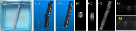 A Simplified 3d Ultrasound Freehand Imaging Framework Using 1d Linear Probe And Low Cost