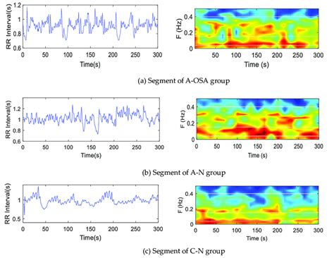 5 Minute Hrv Segment Left 3d Color Power Spectrum Of Hrv Right