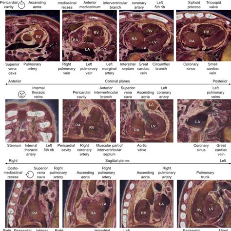 Three Orthogonal Planes Showing Heart Structures Derived From The