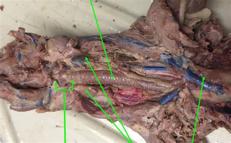 Endocrine Organs Diagram Quizlet