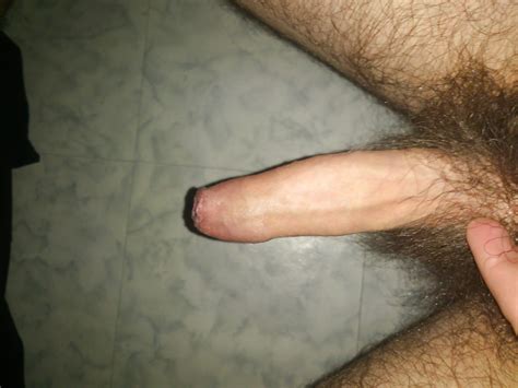 Play Foreskin Picture Video Coment Porn Pictures Xxx Photos Sex Images 1099564 Pictoa