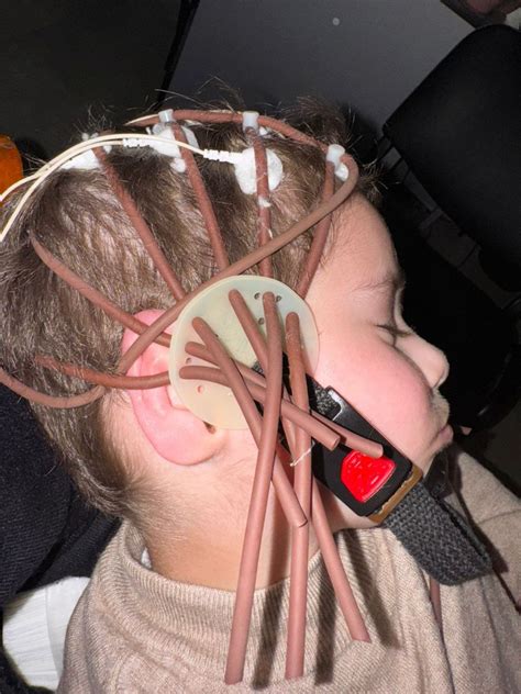 ფონდის მეგობრებო თქვენ მართლაც კიდევ ერთი სასწაული მოახდინეთ შეჭირვებული სნეული ბავშვისთვის