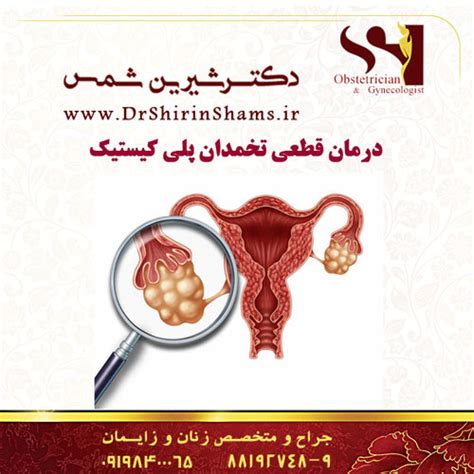درمان قطعی تخمدان پلی کیستیک درمان سندرم تخمدان پلی کیستیک درمان