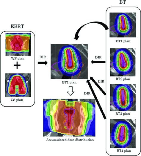 A Schematic Diagram Of The Creation Of The Accumulated Dose Download Scientific Diagram