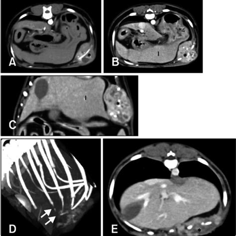 Pre Ad And Post E Operative Computed Tomography Ct Images On