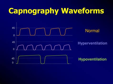 Waveform Capnography Masterclass The Protected Airway