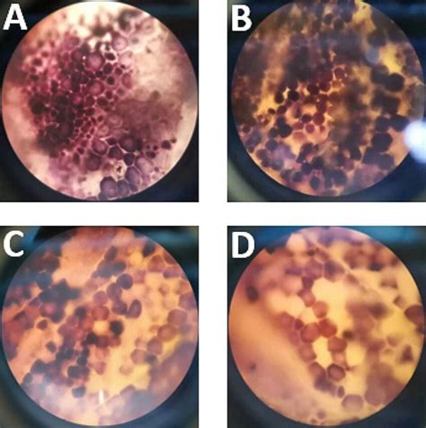 Effect Of Steeping Time On Endosperm Structure Under The Light
