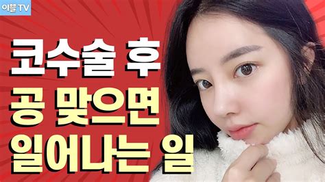 코수술하고 공맞으면 어떻게 될까 😱ㅣ성형 전후 레전드 ㅣ 이쁠tv Youtube