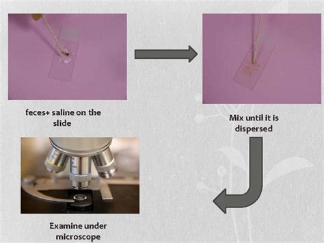Preparation Microscopic Examination Of A Direct Fecal Smear