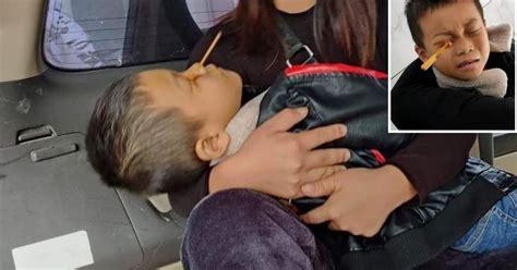 မူဆယ် ရှိ ကလေးငယ်တစ်ဦး ‌ဆော့ကစားရင်း ချော်လဲရာမှ မျက်လုံးထဲ အကင်တုတ်ချွန် စိုက်ဝင်ခဲ့