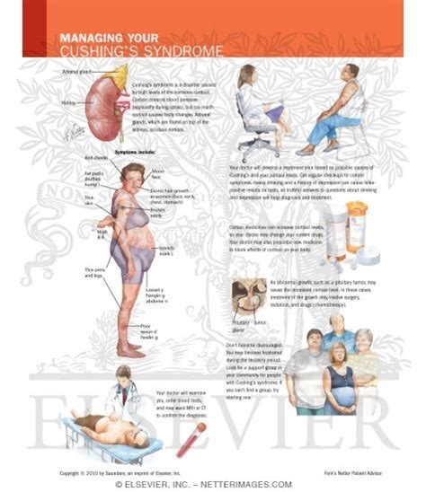 Managing Your Cushings Syndrome