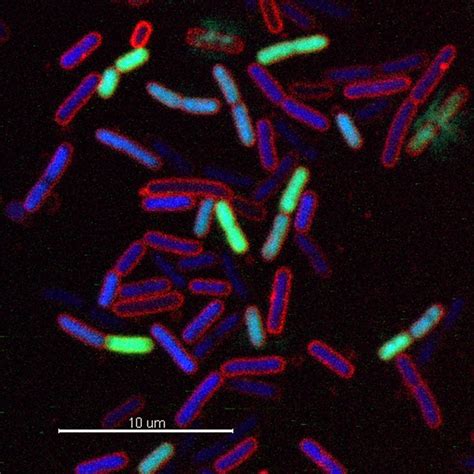 Novel Class Of Antibiotics Brings New Options • Healthcare In