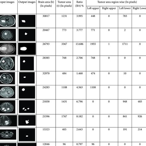 Tumor Segmentation And Its Location For Ground Truth Images Download Table