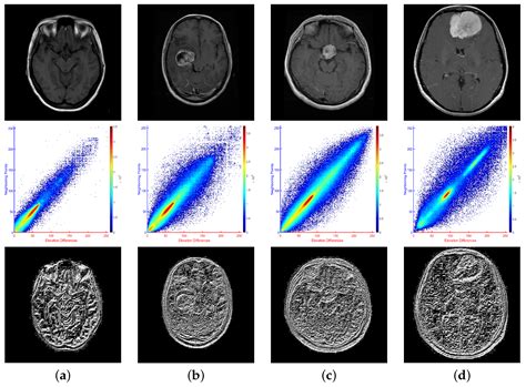 A Hybrid Learning Architecture For Improved Brain Tumor Recognition