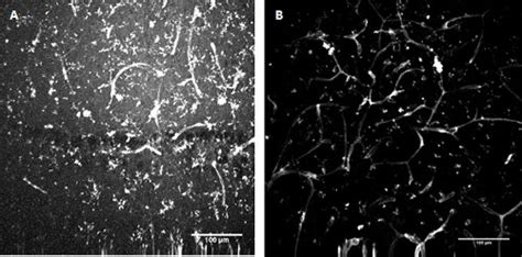 Functional Calcium Imaging In Developing Cortical Networks