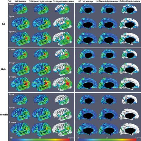 Figure 1 From Mapping Longitudinal Hemispheric Structural Asymmetries Of The Human Cerebral