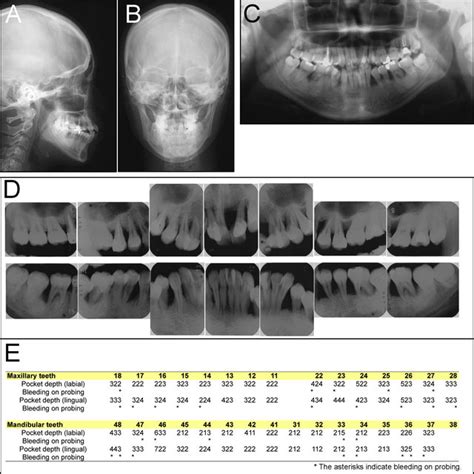Preorthodontic Treatment Radiographs A Lateral Cephalogram B Download Scientific Diagram