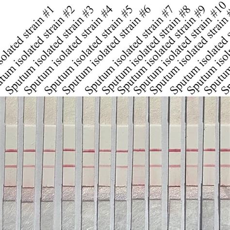 Screening Of The Primer Probe Sets A Rpa Results For Two Different Download Scientific Diagram