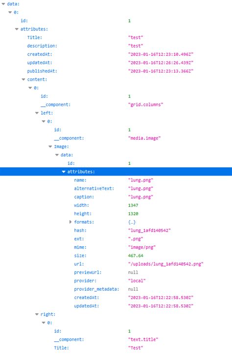Dynamic Zone In Components Content Editing Xp Strapi