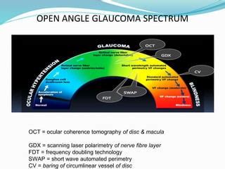 GLAUCOMA PPT