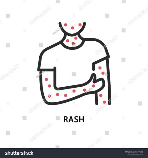 Rash Flat Line Icon Vector Illustration Stock Vector Royalty Free