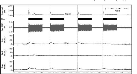 Figure 2 From Conditional Neuromodulation Using Trans Rectal