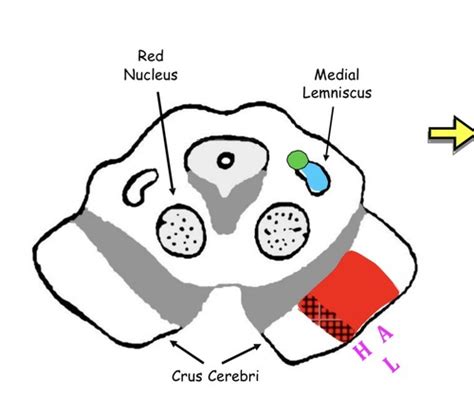 Pathway Lecture Images Flashcards Quizlet