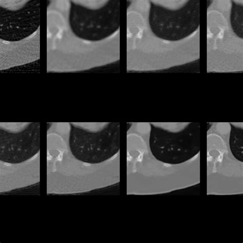 reconstructed intermediate 60 view ct images by fista net at different