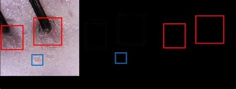 Ssd Uses Multiple Boxes With Preset Sizes To Detect Objects Download Scientific Diagram