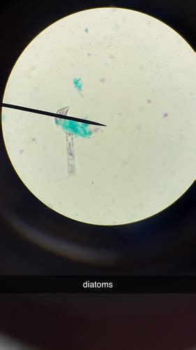 Lab Practical Flashcards Quizlet