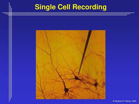 Physiology Of Vision A Swift Overview Ppt Download