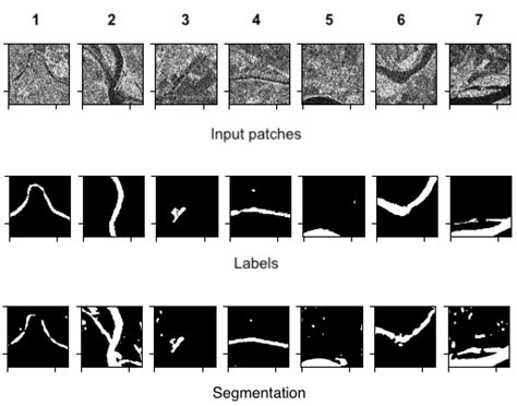Test Samples Segmentation Performed By The Best Model Download Scientific Diagram