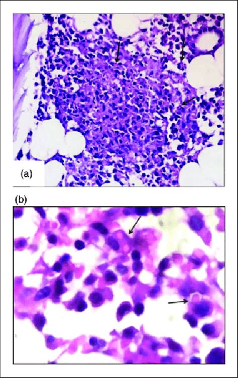 Paraffin Embedded Decalcified Bone Marrow Trephine Biopsy Sections From Download Scientific