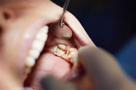 Embarking On A Sandblasting Business Venture