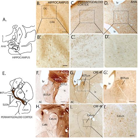Figure 2 From The Neuroanatomic Complexity Of The Crf And Da Systems And Their Interface What