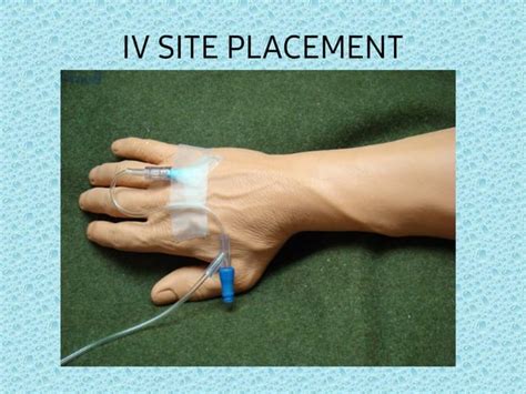 IVT COMPLICATIONS MANAGEMENT Pdf First Aid Injuries