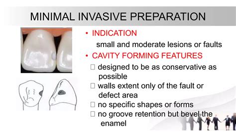Class Iii Cavity Preparation Pptx