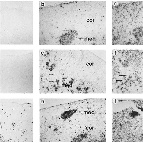 Pdf Two Subsets Of Epithelial Cells In The Thymic Medulla