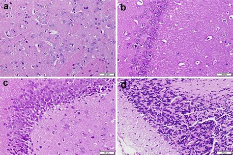Cerebral Cortex Tissue