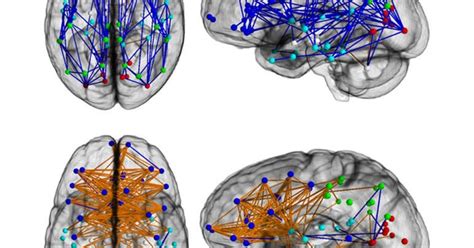 Brain Connectivity Varies Between Men And Women Psychology Today
