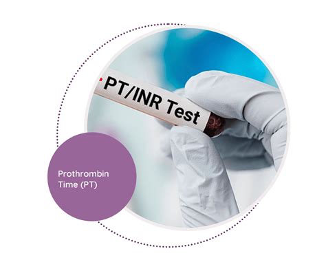 Prothrombin Time Pt Mediscan Lab