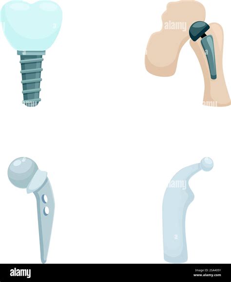 Vector Illustration Of Different Medical Implants For Dentistry And