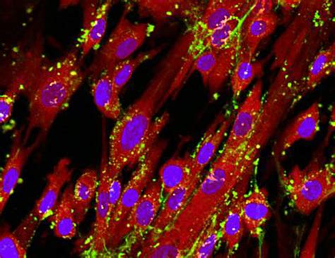 Cell Sex A Factor In Nanoparticle Uptake And Efforts To Change Cell Fate