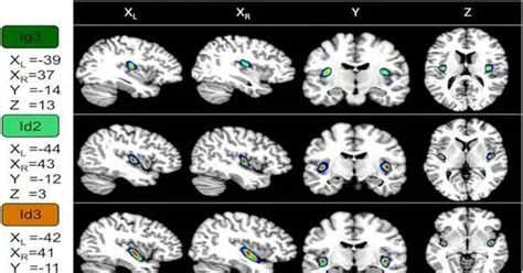 Seven Additional Regions Of The Insular Cortex Are Discovered By Researchers QS Papers
