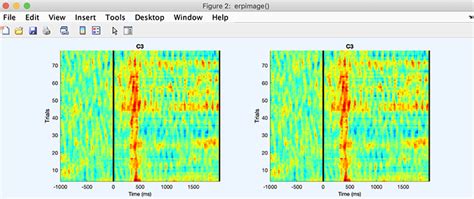 Matlab 2009 Open Variables Itypodend