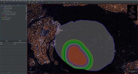 resolving image hierarchy for margin annotation in qupath usage and issues image sc forum