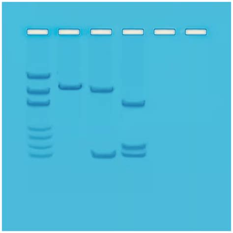 Mapping Of Restriction Sites On Plasmid Dna Biotek