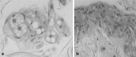 A Vacuolated Cytoplasm Of Submucosal And Myenteric Plexus Colon Cells